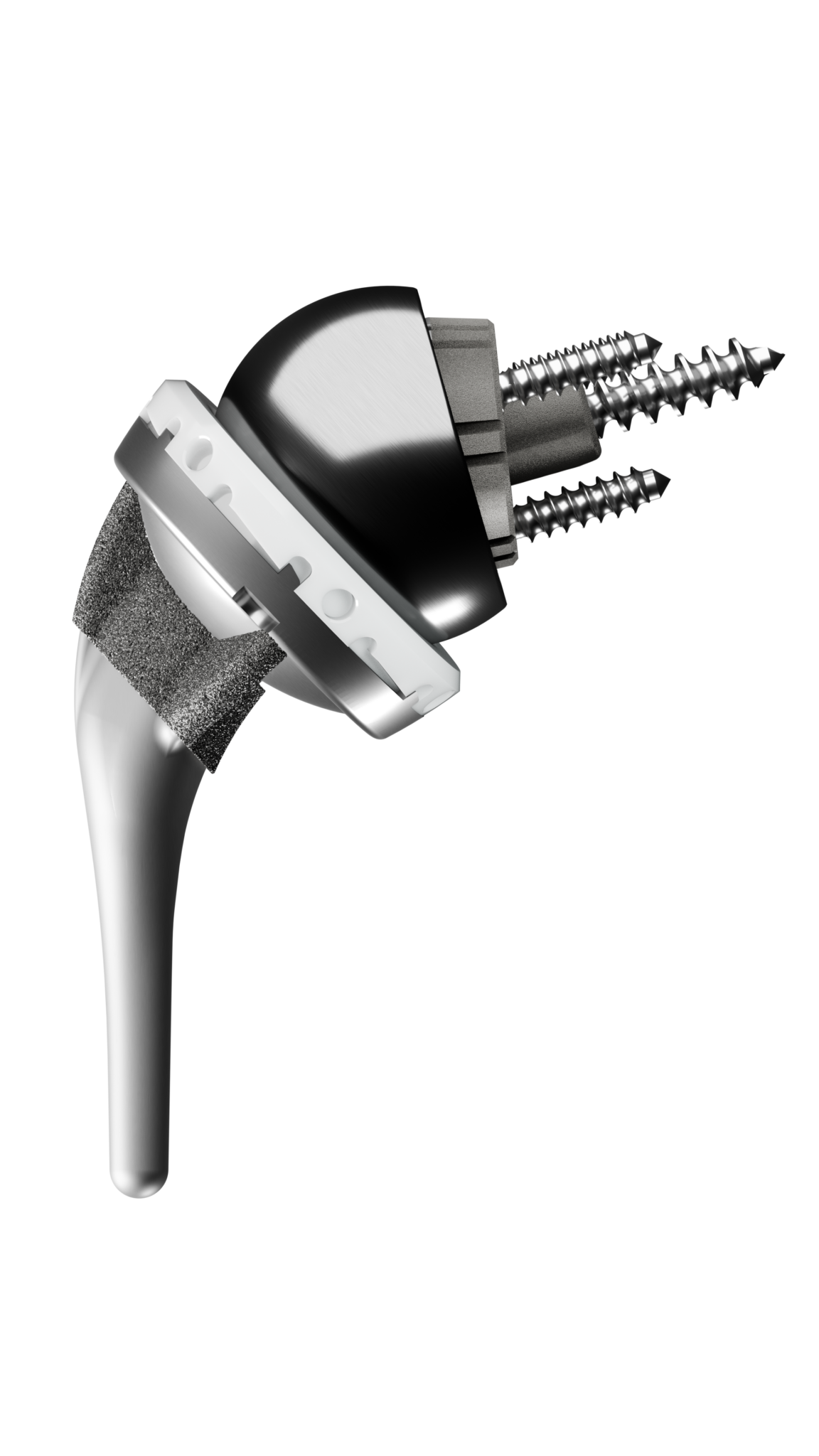 What Happens to Rotator Cuff Muscles After Reverse Shoulder Replacement Surgery - Dr. Eric Giang