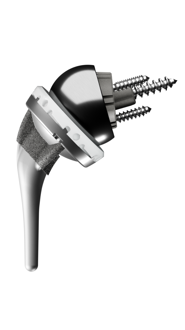 What Happens to Rotator Cuff Muscles After Reverse Shoulder Replacement ...