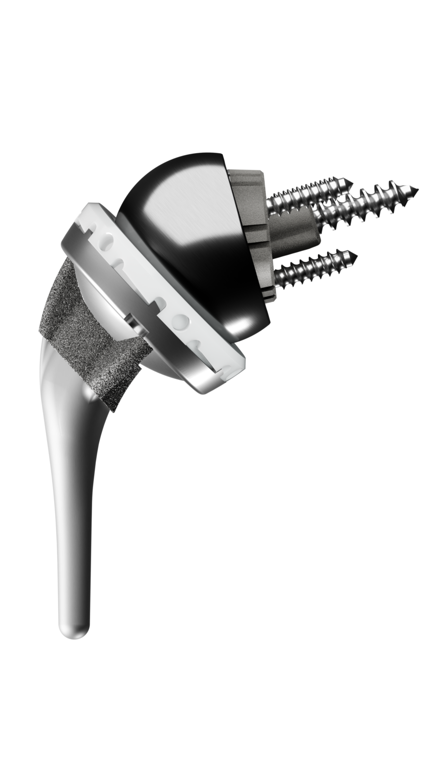 What Happens to Rotator Cuff Muscles After Reverse Shoulder Replacement ...